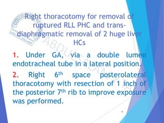 Thoracic Approach for Removal of Hydatid Cysts of the Right Lung and ...
