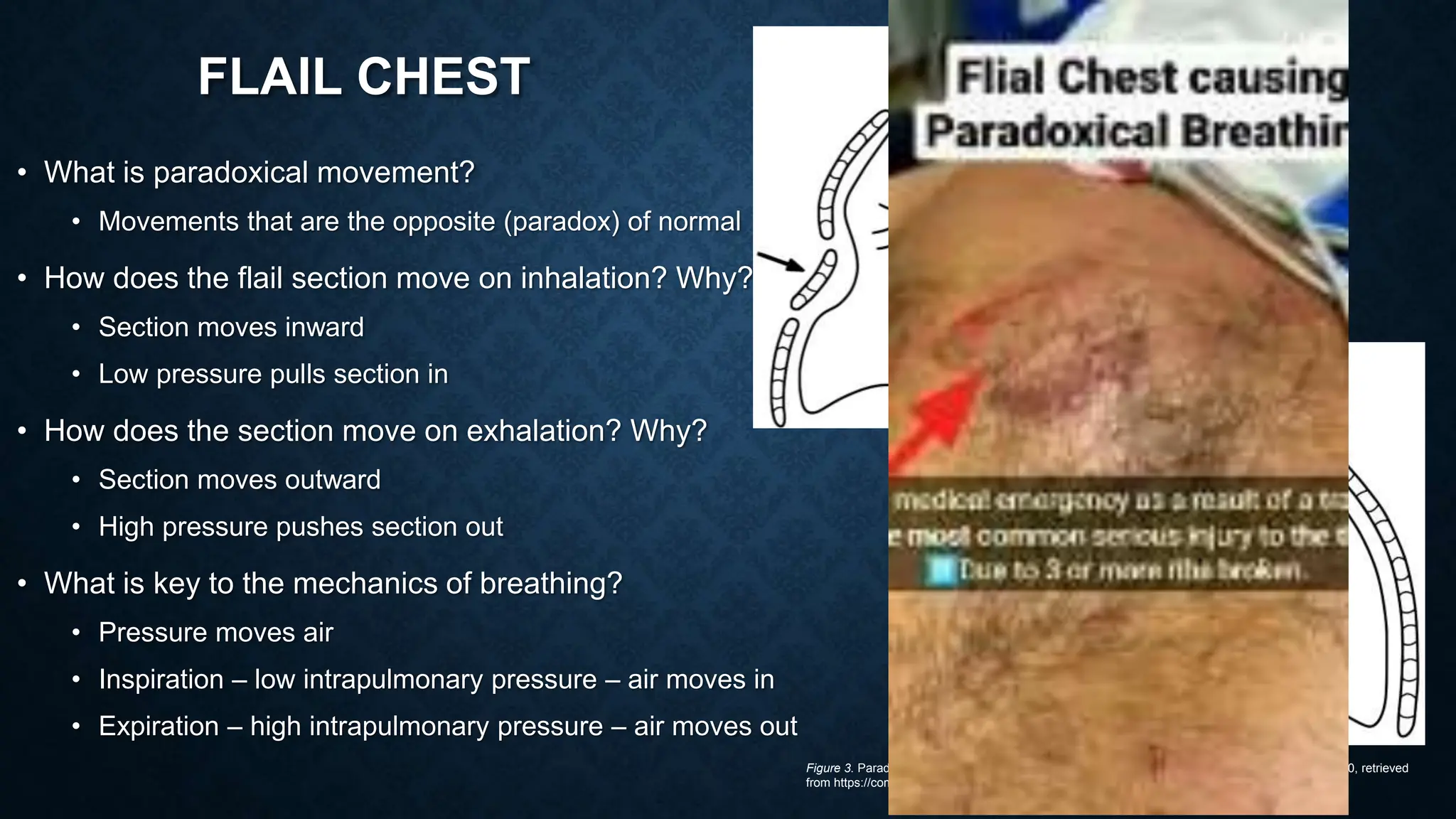 Thoracic Cavity Case Study 1 lesson slides v2.pptx