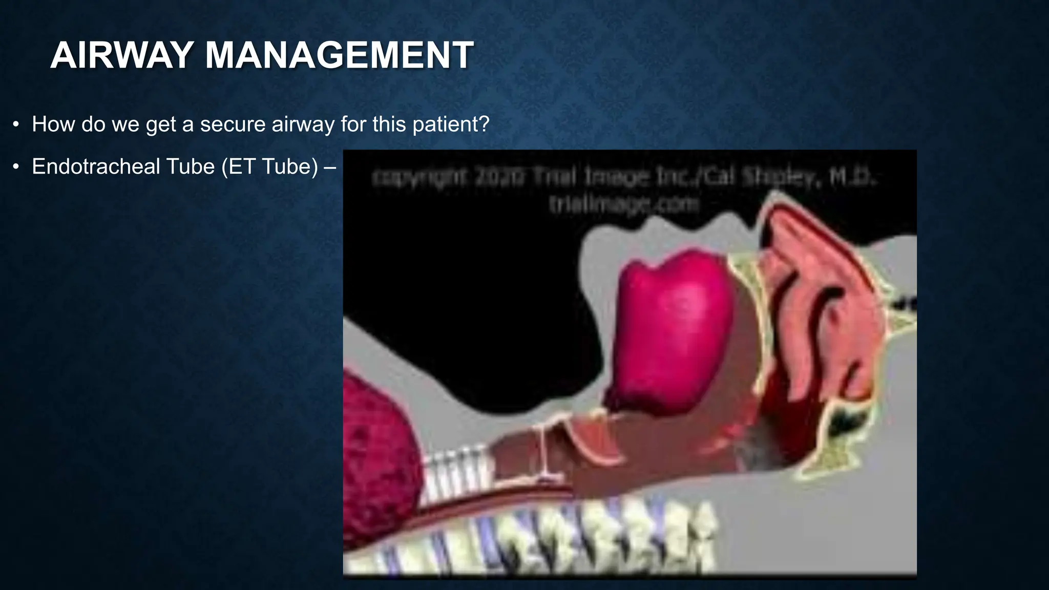 Thoracic Cavity Case Study 1 lesson slides v2.pptx