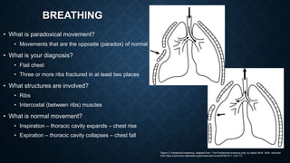 Thoracic Cavity Case Study 1 lesson slides v2.pptx