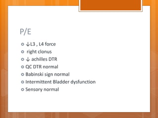 Thoracic disc disease | PPTX