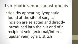 Thoracic duct injury in neck dissection | PPTX