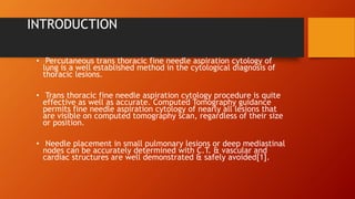 Thoracic fnac ct guided | PPTX