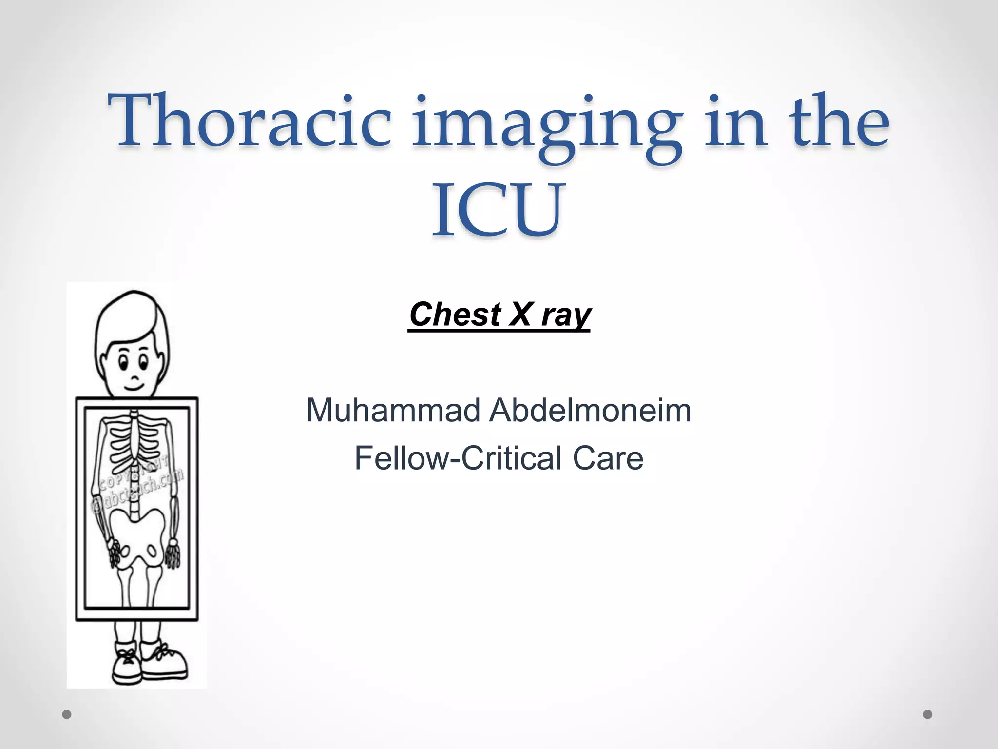 Thoracic imaging in icu | PPTX