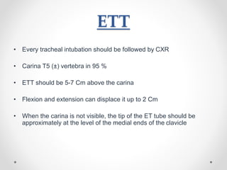 Thoracic imaging in icu | PPTX