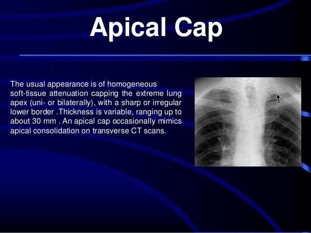 Thoracic imaging terms part 1