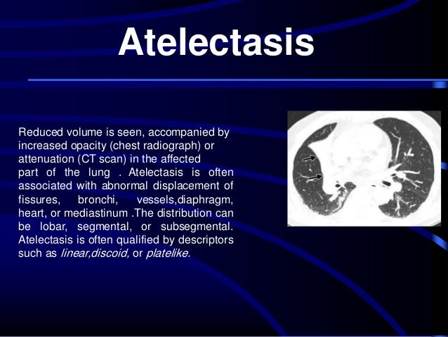 Thoracic imaging terms part 1