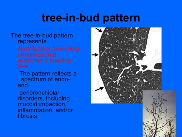 Thoracic imaging terms (I)
