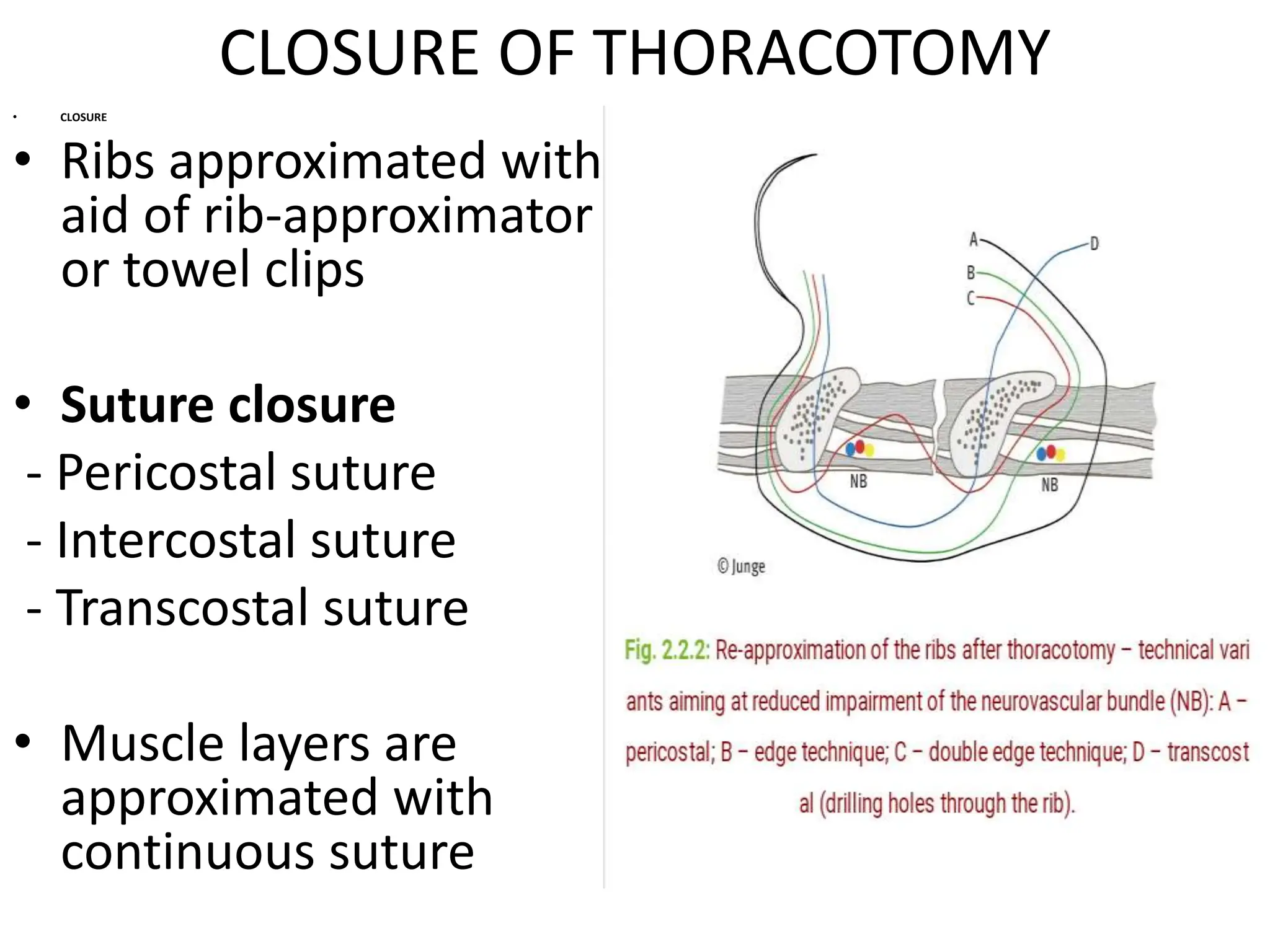 THORACIC INCISIONS a powerpoint for general surgeons | PPTX