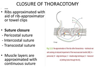 THORACIC INCISIONS a powerpoint for general surgeons | PPTX