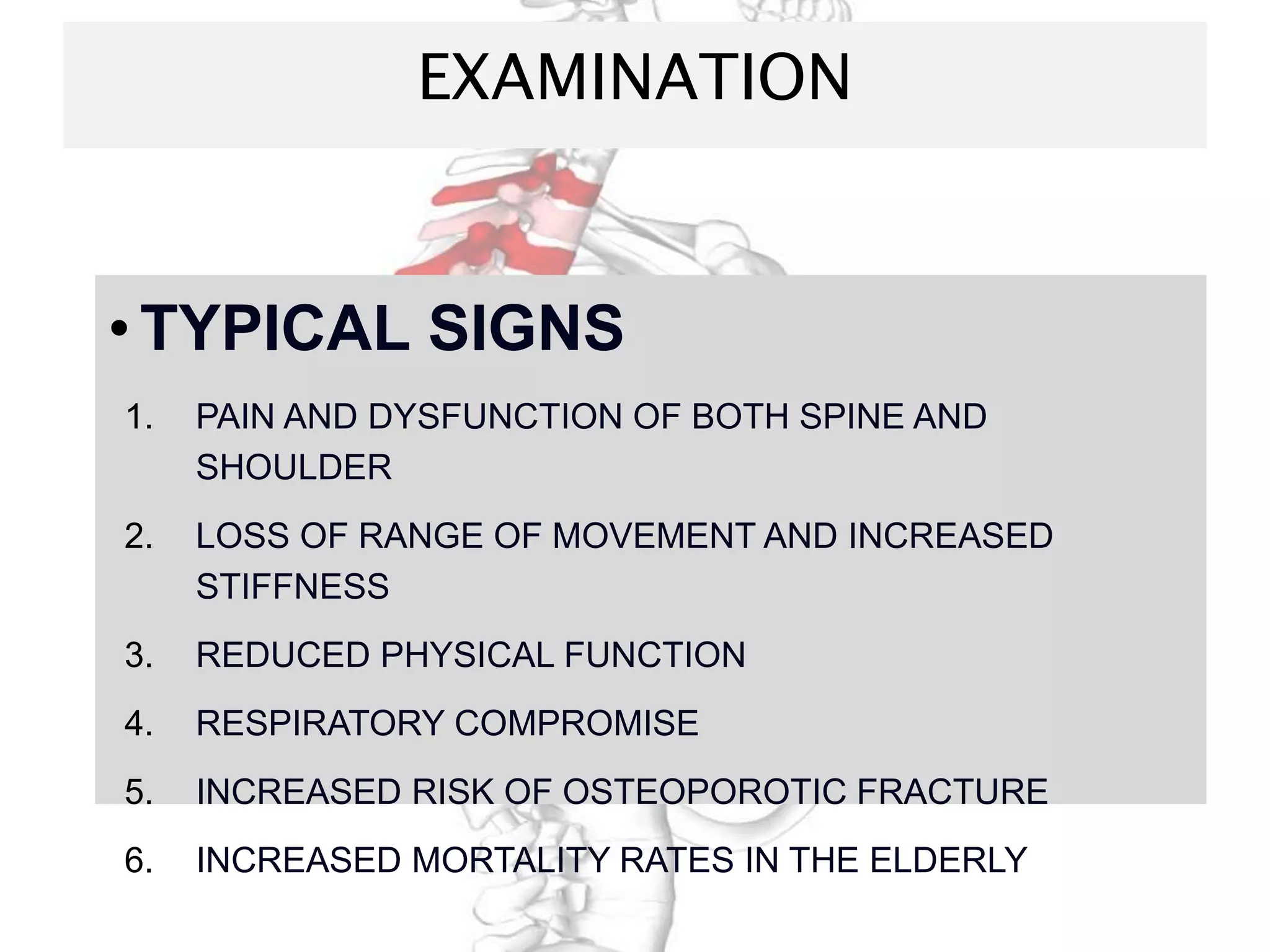 Thoracic kyphosis/ Thoracic hyperkyphosis | PPTX | Death, Injury, or ...