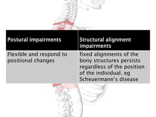 Thoracic kyphosis/ Thoracic hyperkyphosis | PPTX