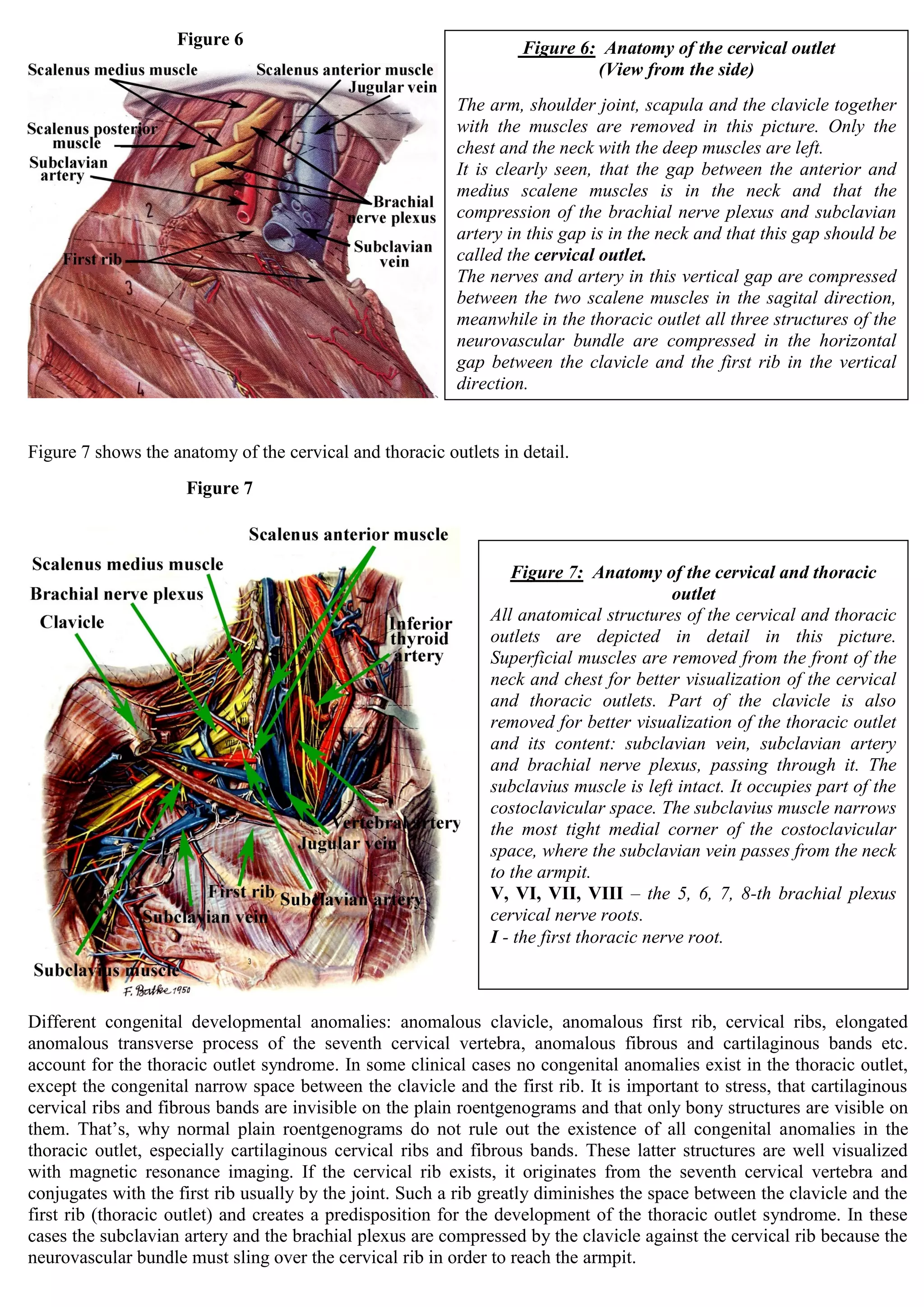 Thoracic Outlet Syndrome: Anatomy, Symptoms, Diagnostic Evaluation and ...