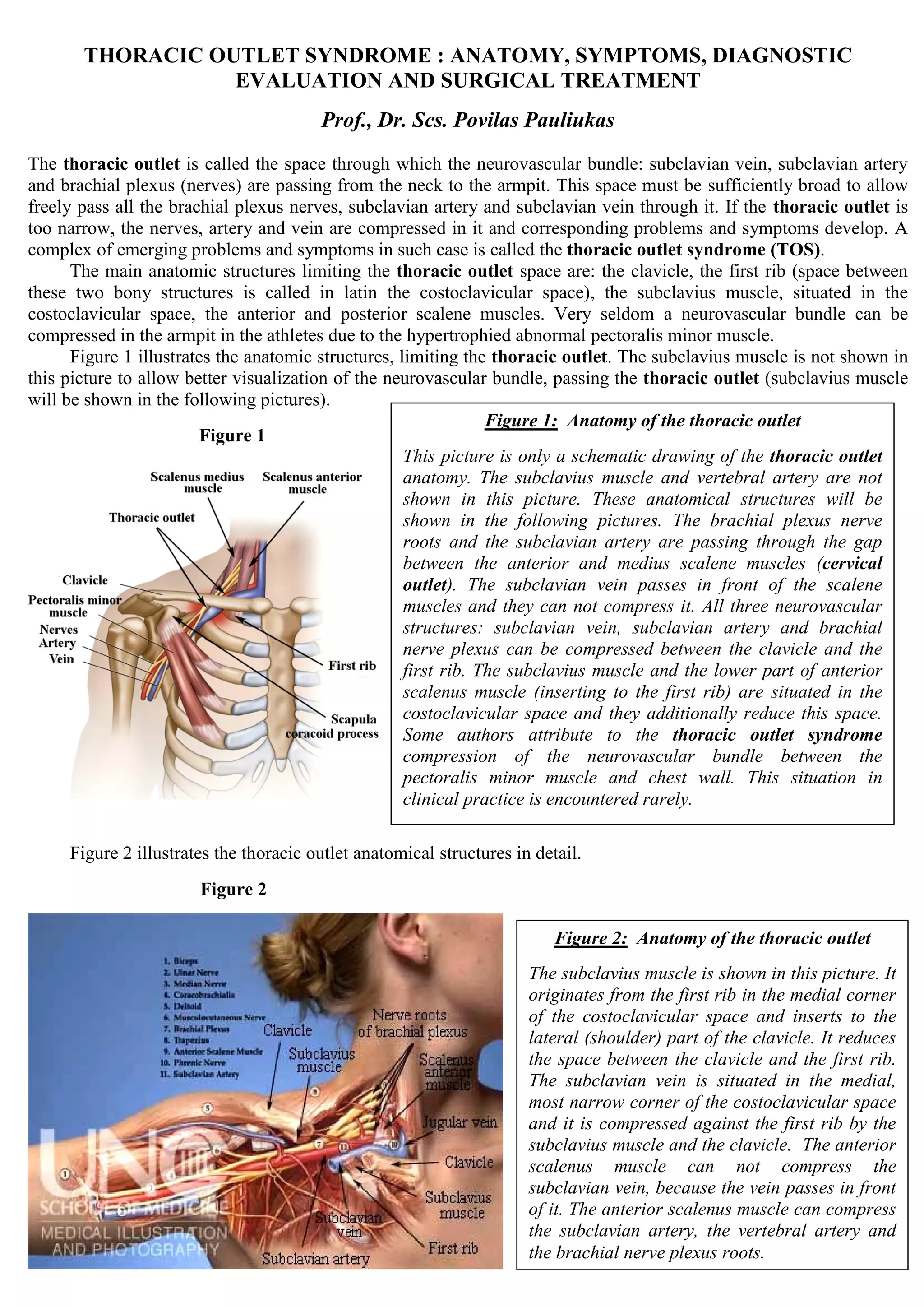 Thoracic Outlet Syndrome: Anatomy, Symptoms, Diagnostic Evaluation and ...