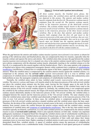 Thoracic Outlet Syndrome: Anatomy, Symptoms, Diagnostic Evaluation and ...