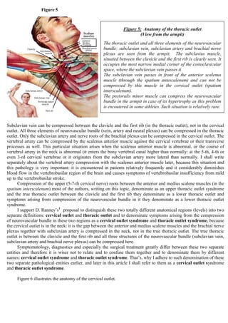 Thoracic Outlet Syndrome: Anatomy, Symptoms, Diagnostic Evaluation and ...