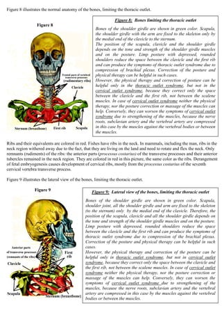 Thoracic Outlet Syndrome: Anatomy, Symptoms, Diagnostic Evaluation and ...