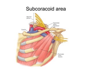 Thoracic outlet syndrome | PPT