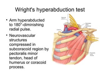 Thoracic outlet syndrome | PPT