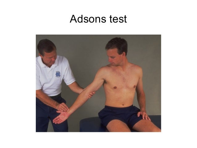 Thoracic outlet syndrome