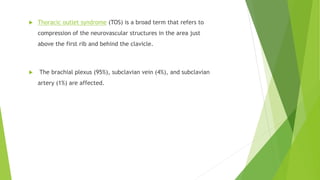 Thoracic outlet syndrome | PPTX