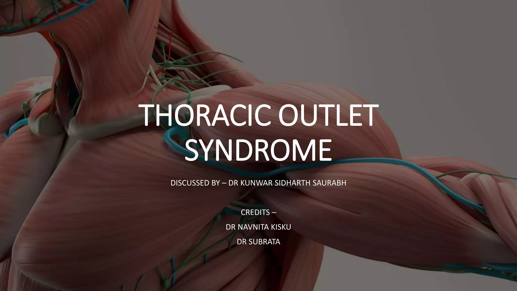 Thoracic outlet syndrome | PPTX