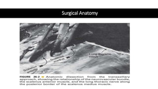 Thoracic outlet syndrome | PPT