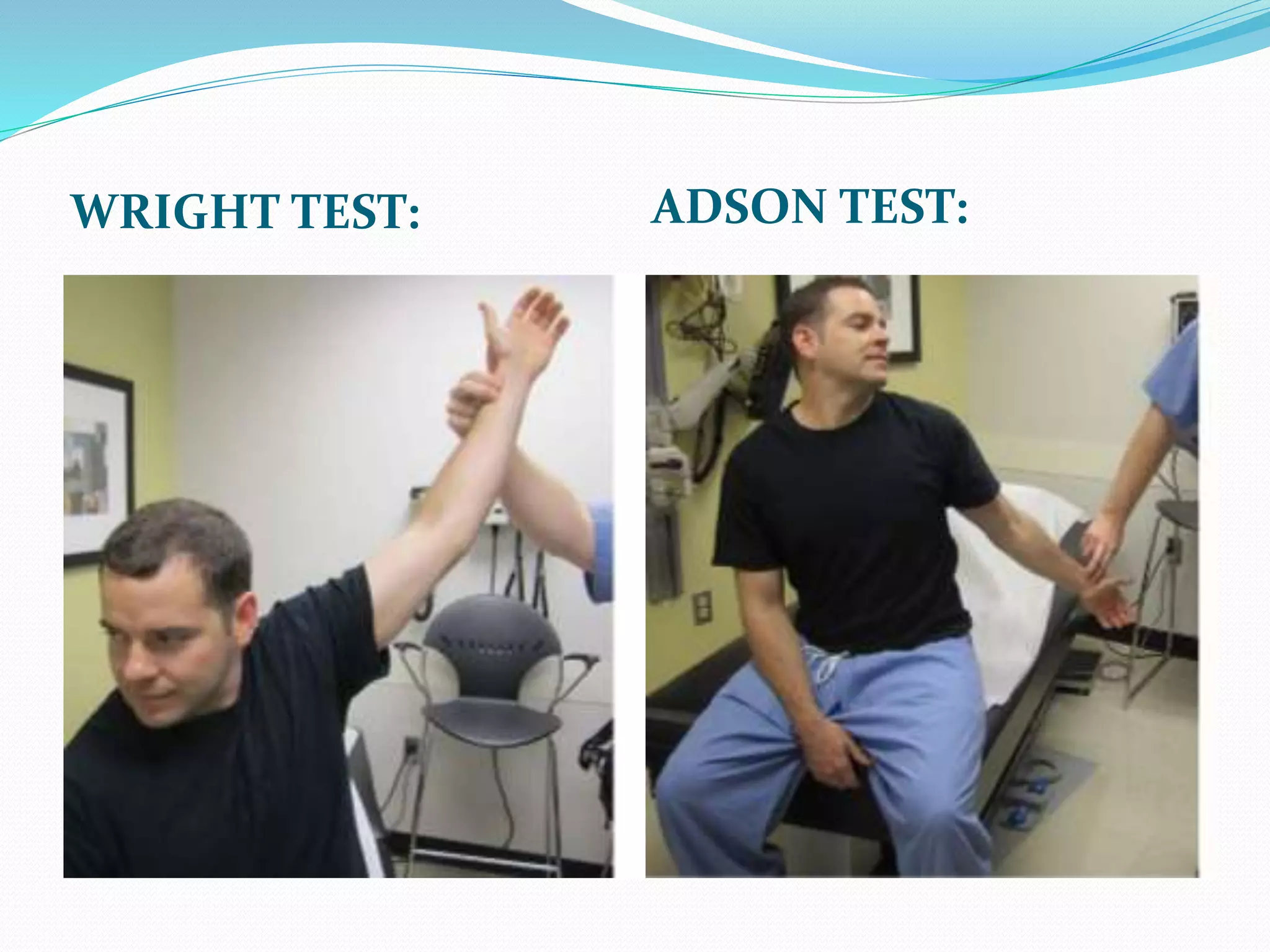 Thoracic outlet syndrome/ TOS | PPTX | Death, Injury, or Military ...