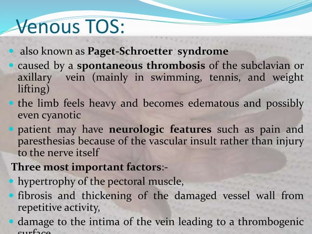 Thoracic outlet syndrome/ TOS | PPTX | Death, Injury, or Military ...