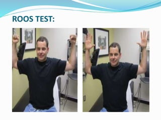 Thoracic outlet syndrome/ TOS | PPTX