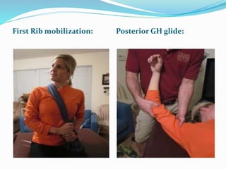 Thoracic outlet syndrome/ TOS | PPTX | Death, Injury, or Military ...