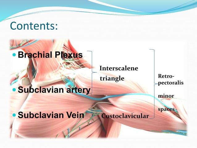 Thoracic outlet syndrome/ TOS | PPTX | Death, Injury, or Military ...