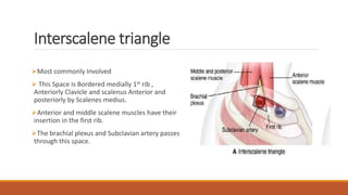 Thoracic Outlet Syndrome and Physiotherapy Management | PPTX