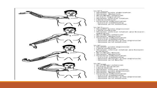 Thoracic Outlet Syndrome and Physiotherapy Management