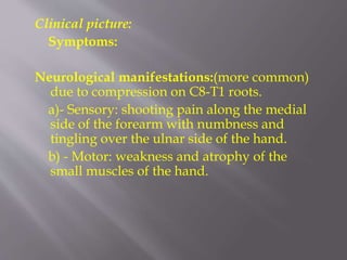 Thoracic outlet syndrome | PPT