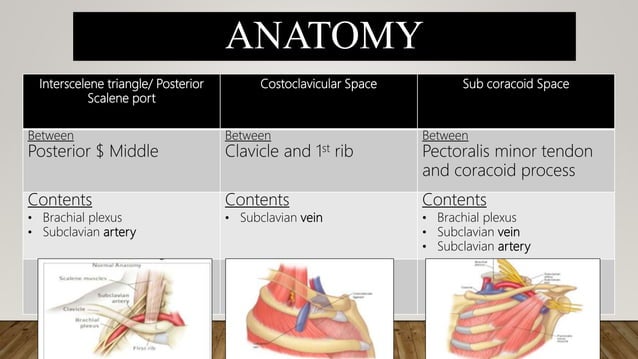 Thoracic outlet syndrome/ TOS | PPTX | Death, Injury, or Military ...