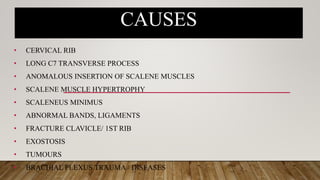 Thoracic outlet syndrome/ TOS | PPTX