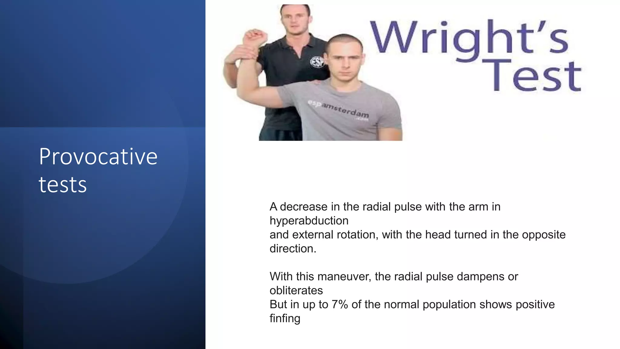 Thoracic outlet syndrome. | PPTX