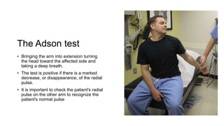 Thoracic outlet syndrome. | PPTX