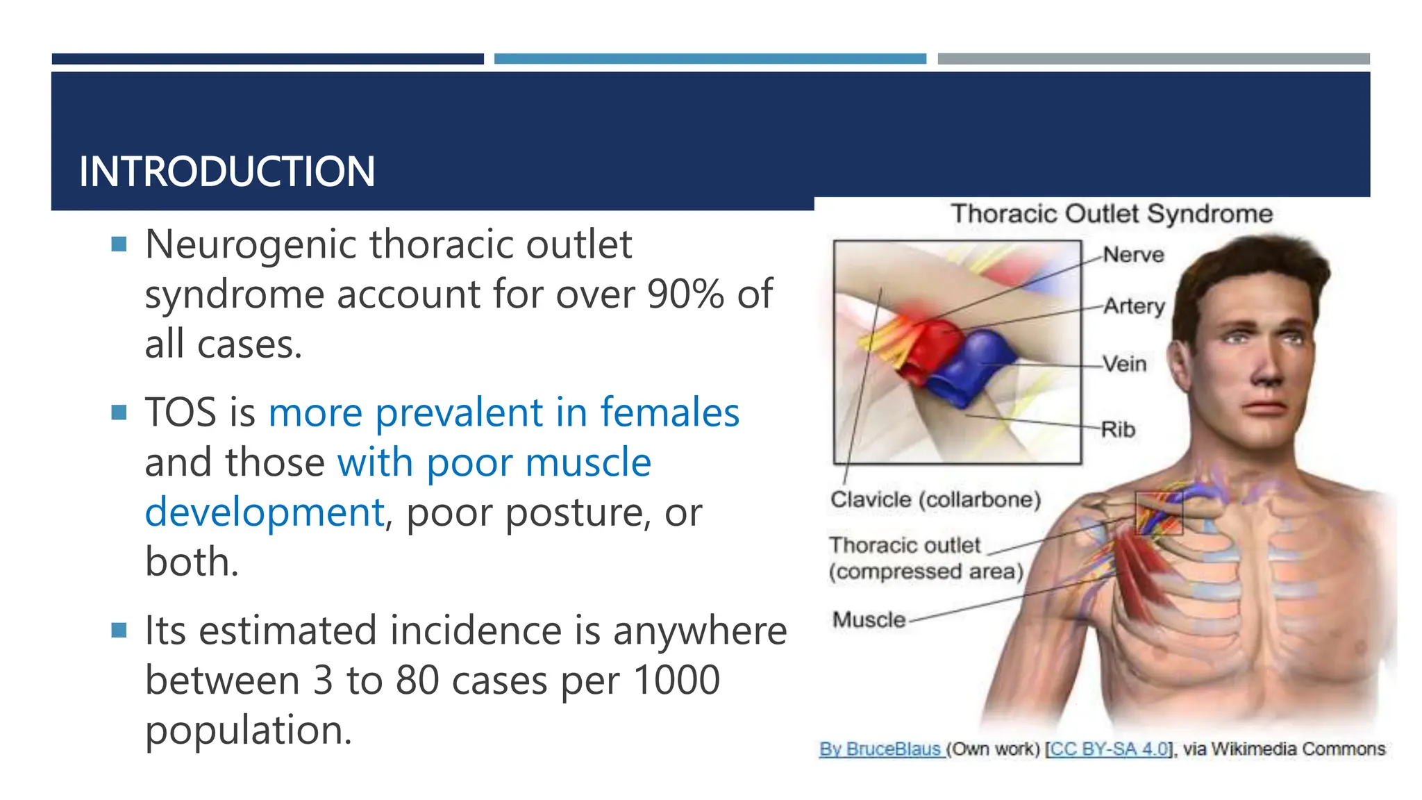 Thoracic Outlet Syndrome.pptx | Death, Injury, or Military Conflict | Sensitive Topics