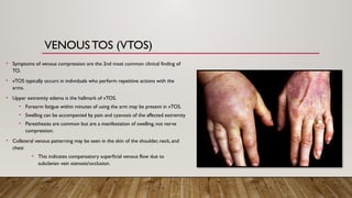 Thoracic Outlet Syndrome Review and Guidelines | PPT