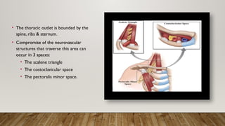 Thoracic Outlet Syndrome Review and Guidelines | PPTX