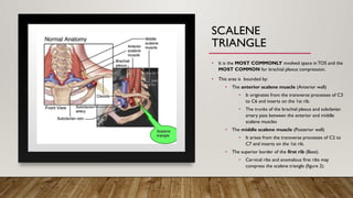 Thoracic Outlet Syndrome Review and Guidelines | PPT