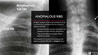 Thoracic Outlet Syndrome Review and Guidelines | PPT