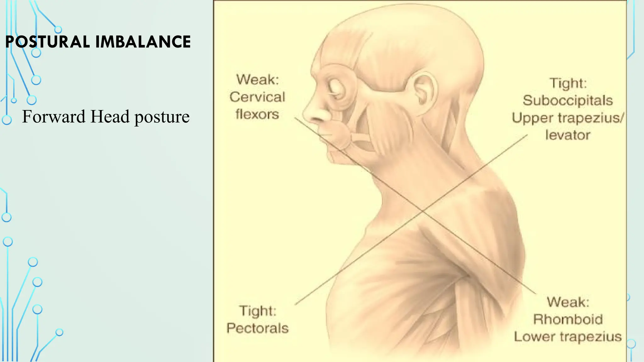 THORACIC OUTLET SYNDROME(TOS)-PPT..pptx