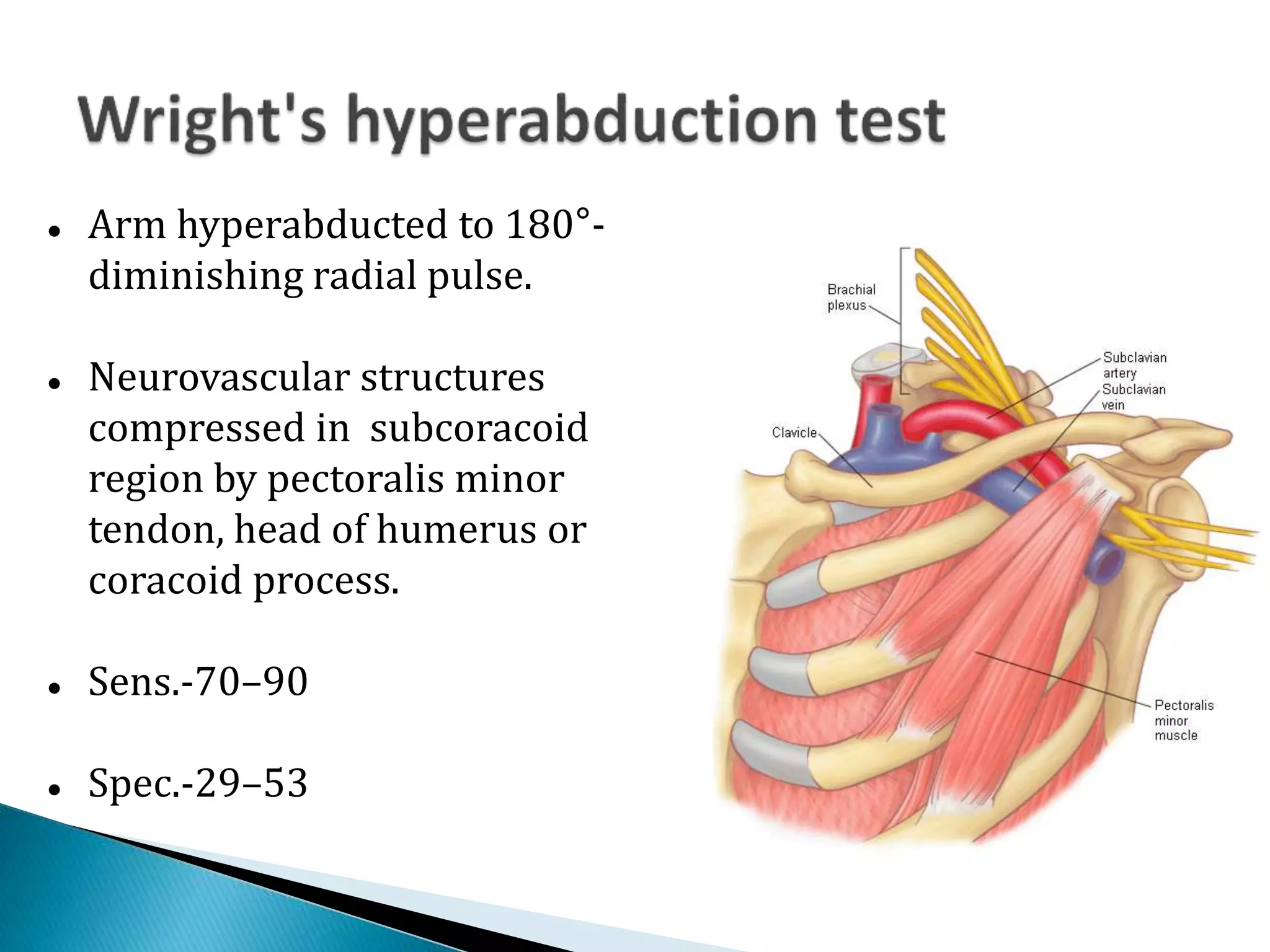 Thoracic outlet syndrome | PPTX