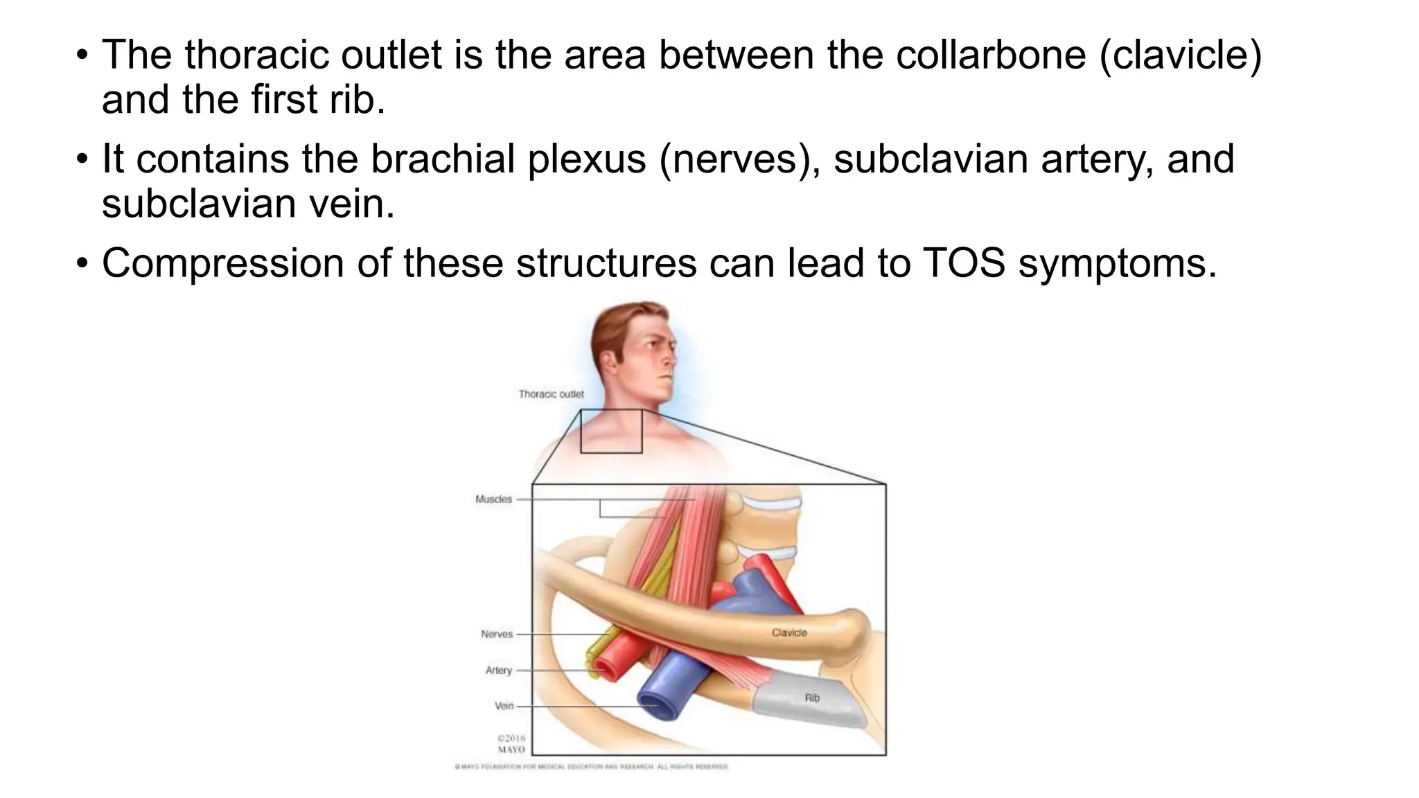 Thoracic Outlet Syndrome and Dorsal Sympathectomy.pptx