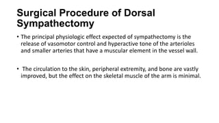 Thoracic Outlet Syndrome and Dorsal Sympathectomy.pptx