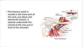thoracic outlet syndrome .pdf