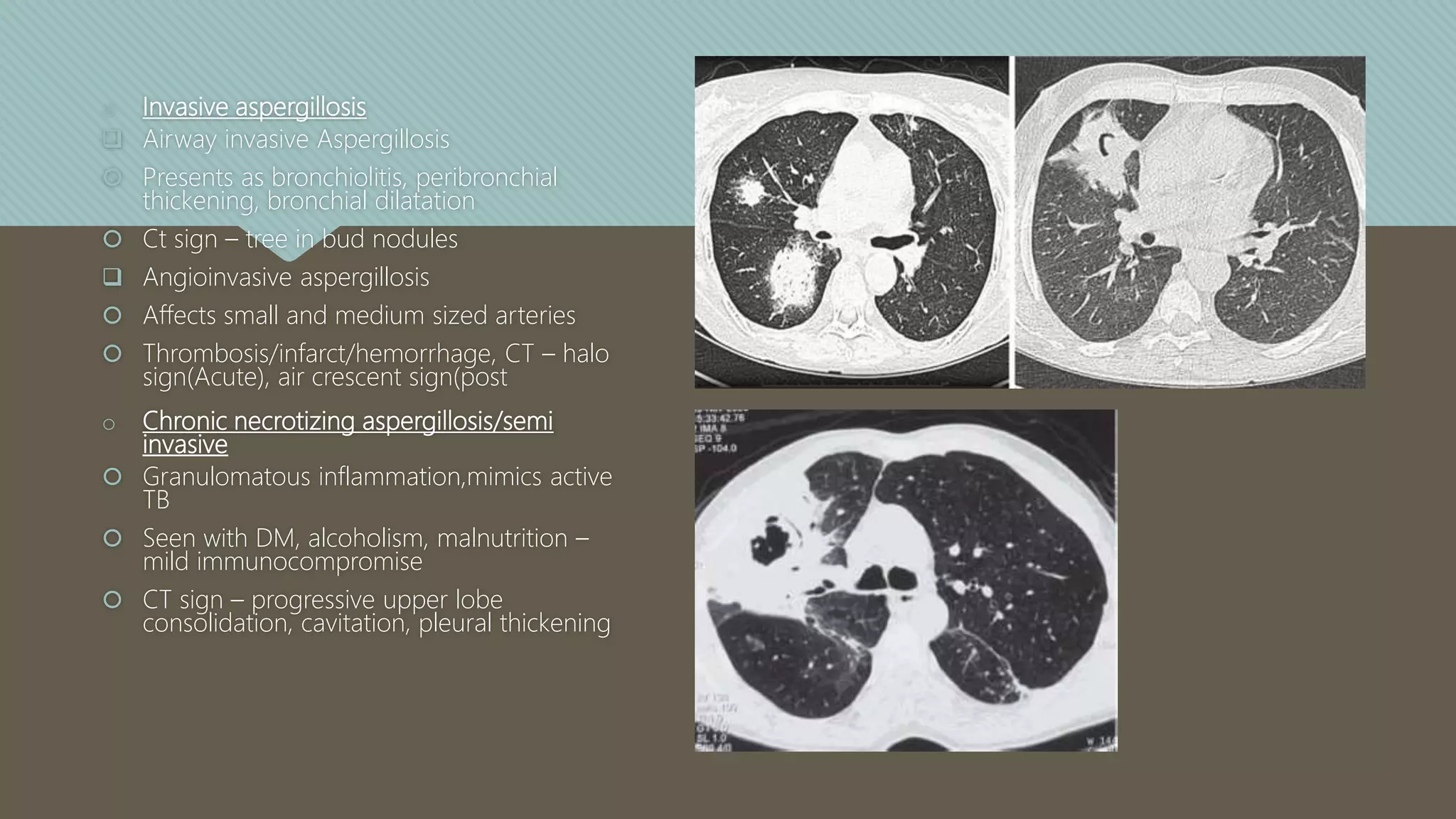 Thoracic pathologies in immunocompromised | PPTX